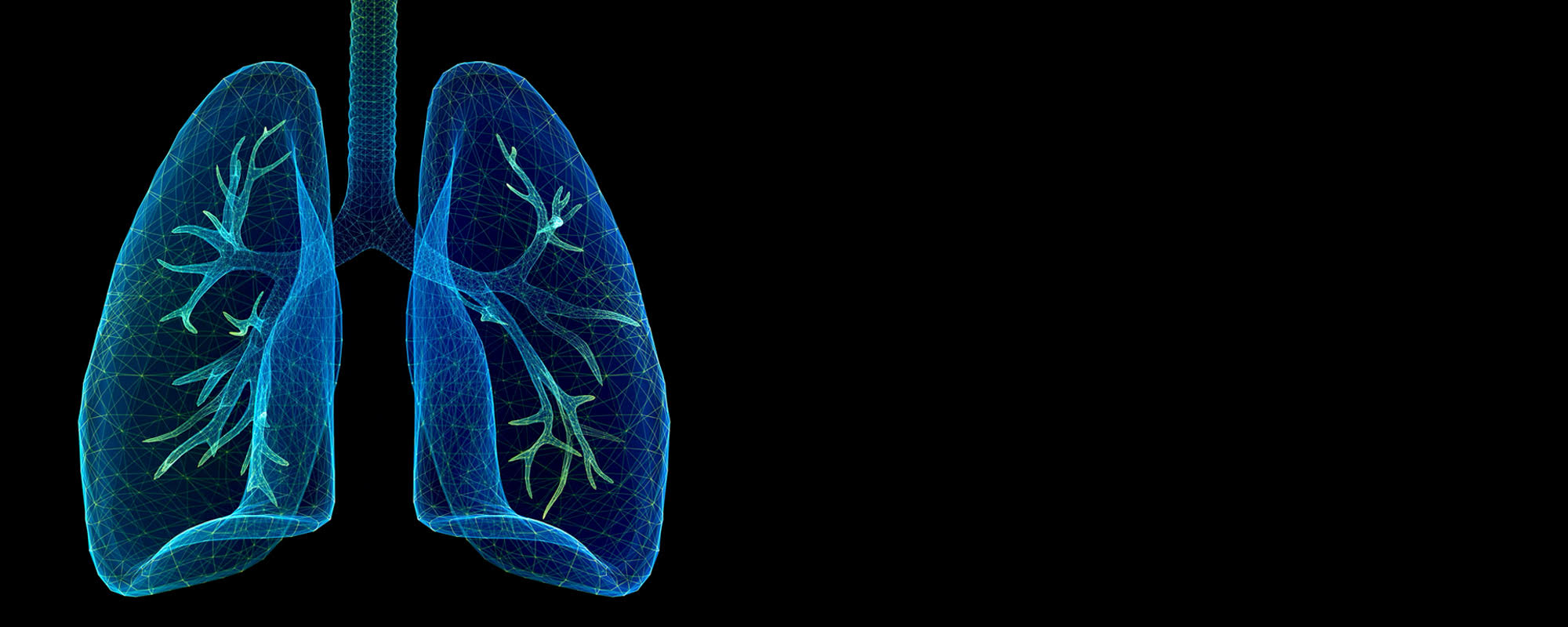 A New Vision for Lung Cancer Treatment. - Prothea Technologies